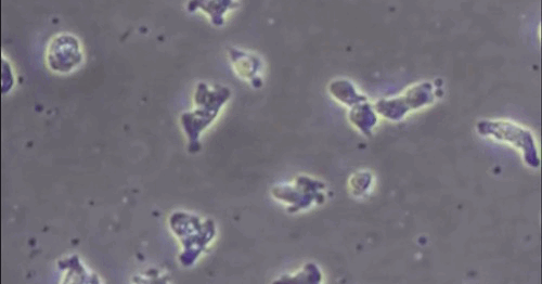 Died After Rinsing Nose With Tap Water Another Brain Eating Amoeba With 97 Fatality Rate